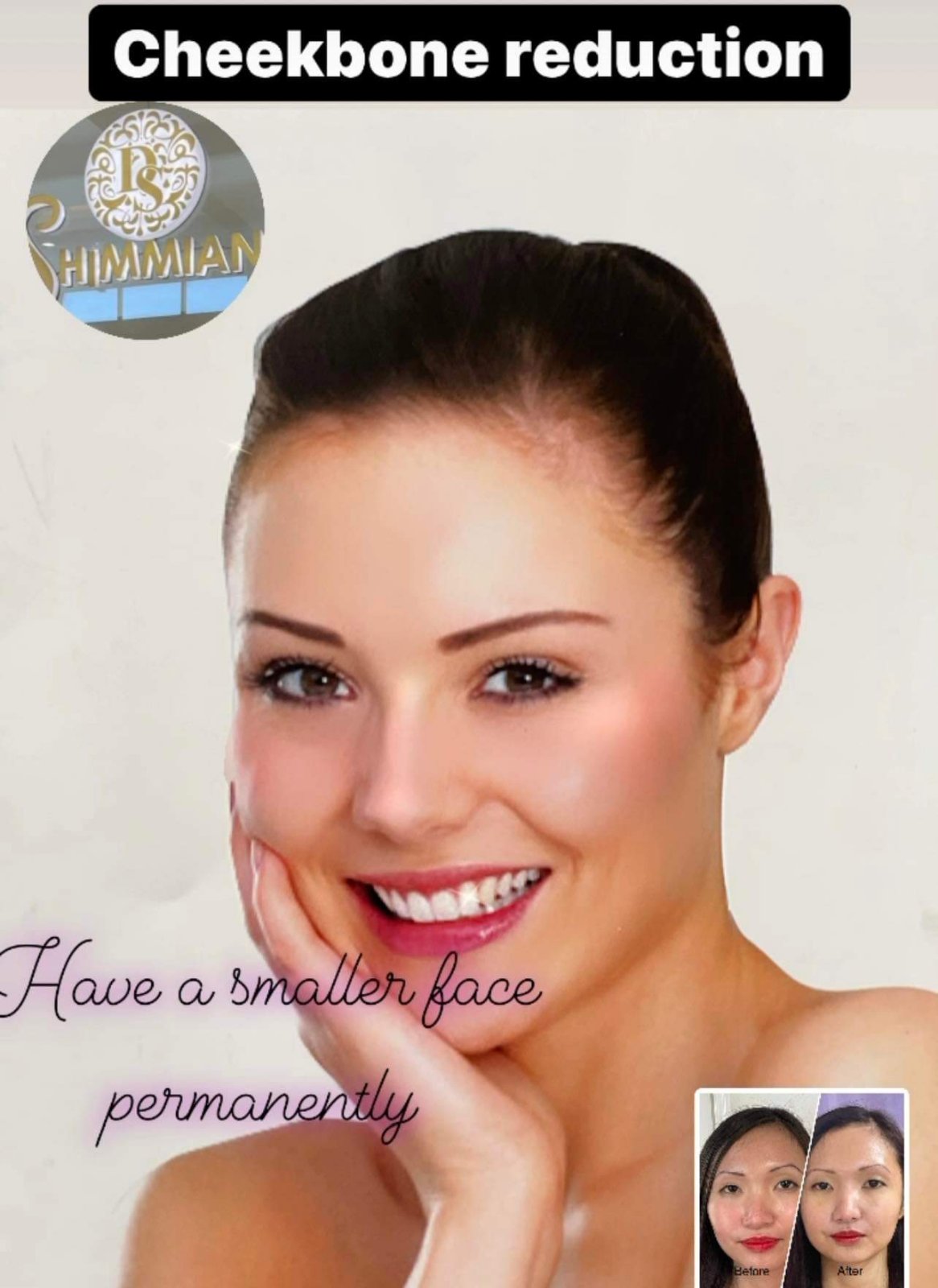 Cheekbone reduction the only sure way to make your face smaller ...